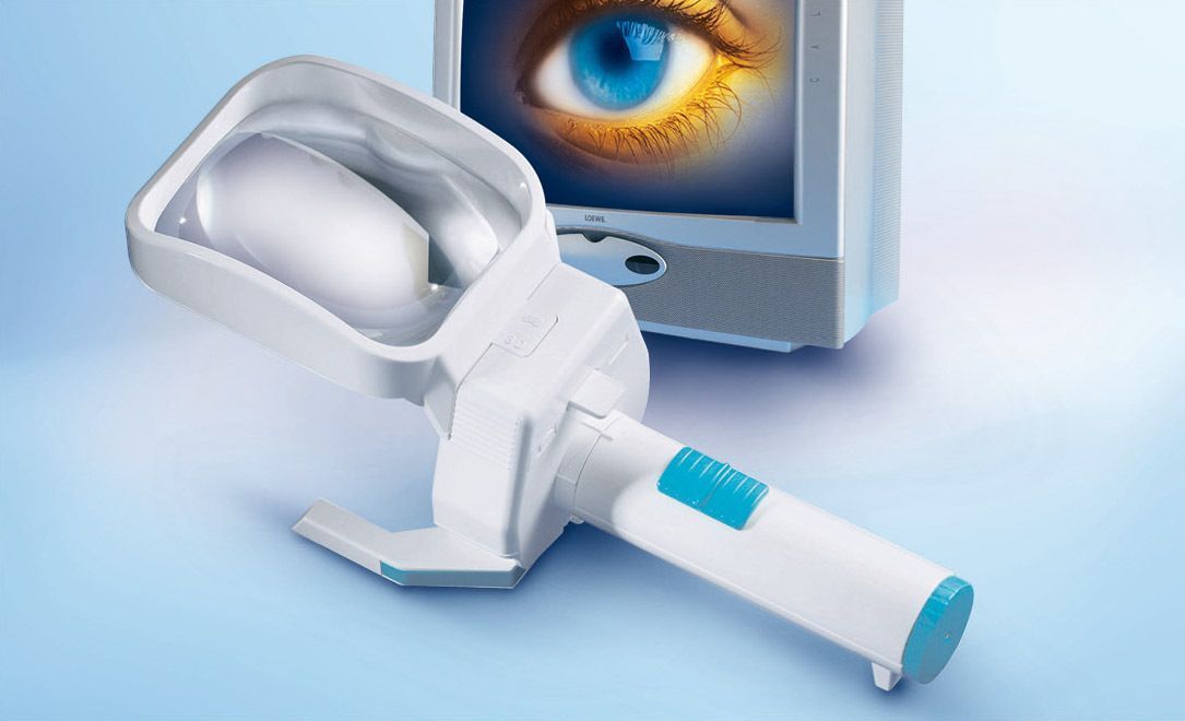 History | Schweizer Optik